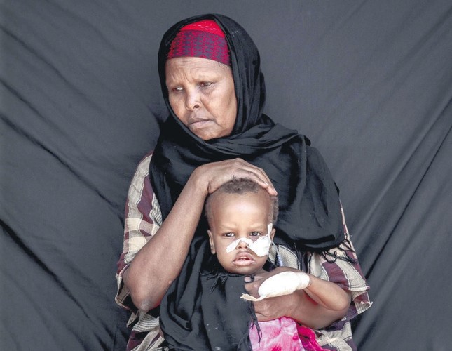 Somalia: A bitter journey of hope for sick children - Daily Sabah